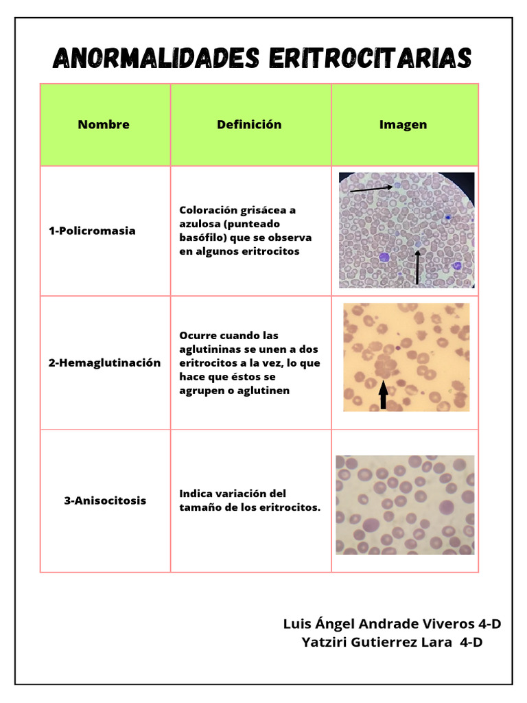 Anormalidades de los Eritrocitos | PDF | Glóbulo rojo | Fisiología