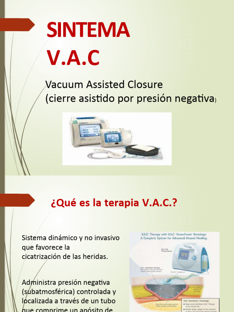 Sintema V.A.C: Vacuum Assisted Closure (Cierre Asistido Por Presión ...
