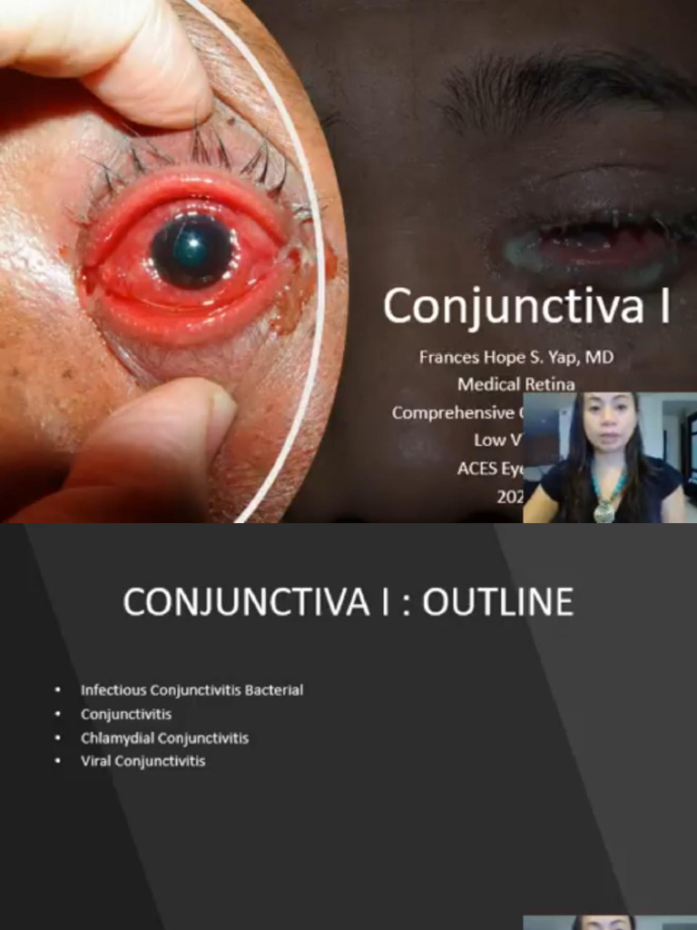 Conjunctiva Part 1 | PDF