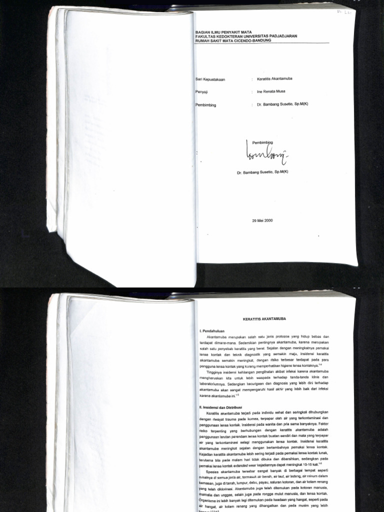 Keratitis Akantamuba - Ine Renata Musa | PDF