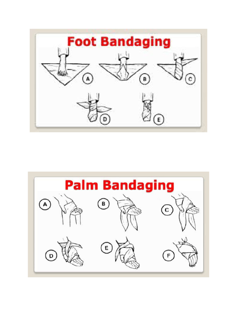 Bandaging Techniques | PDF
