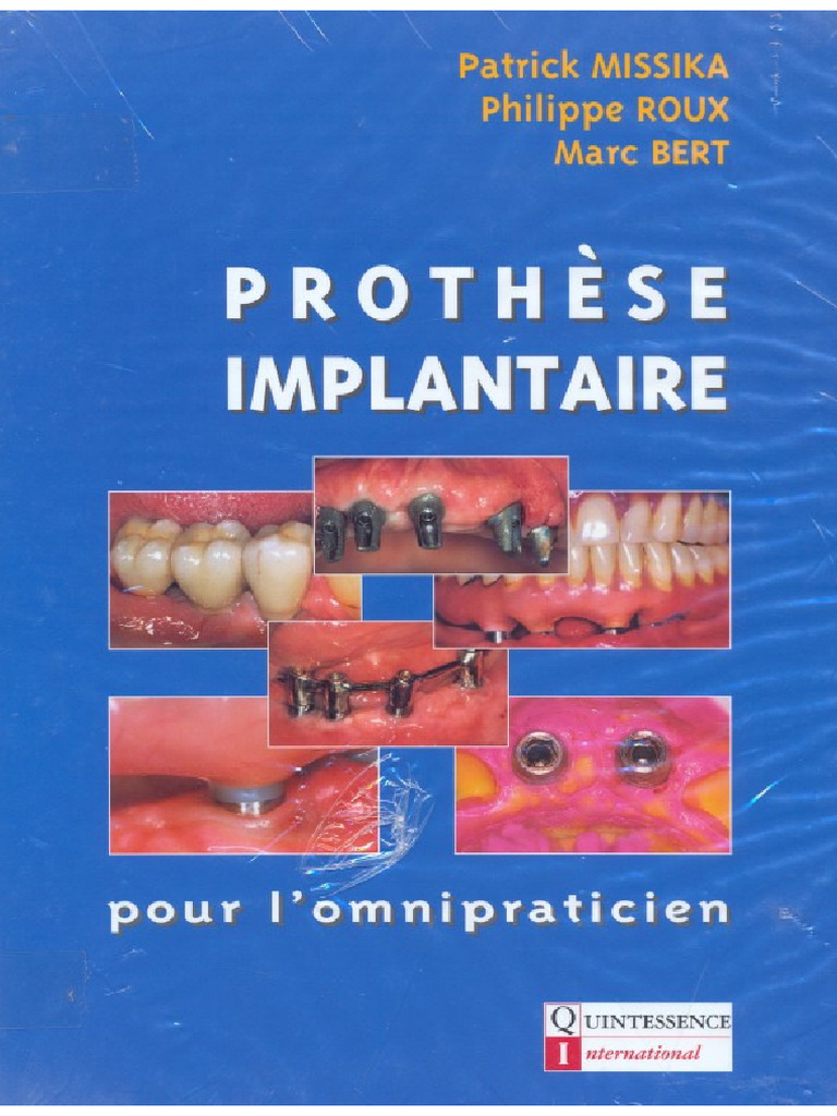Prothese Implantaire Pour Lomnipraticien | PDF