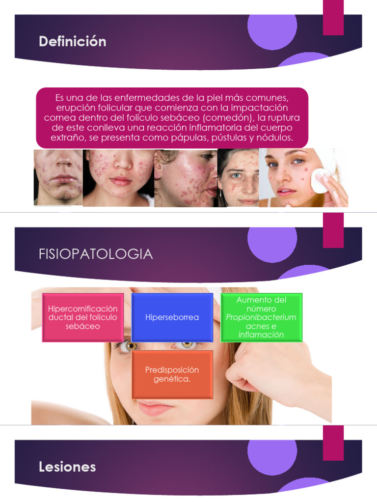 PROTOCOLO Acné | PDF | Cuerpo humano | Sistema tegumentario