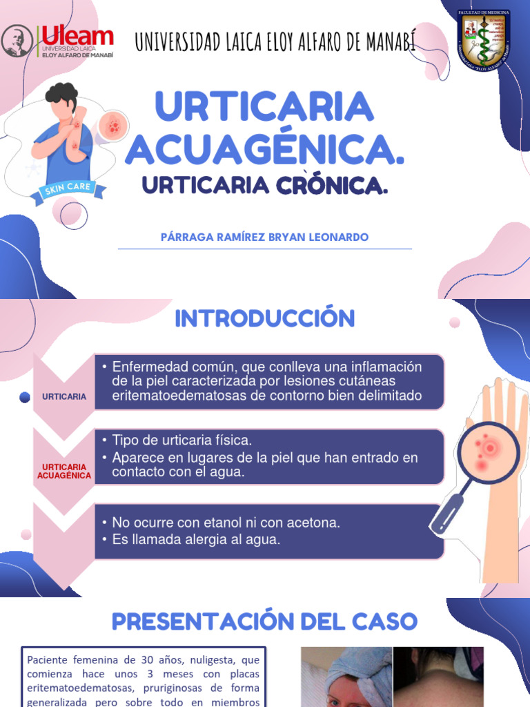 URTICARIA | PDF | Condiciones cutáneas | Medicina