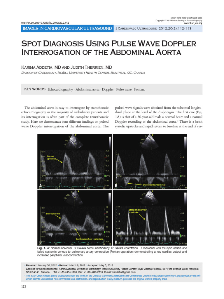 Spot Diagnosis Using Pulse Wave Doppler Interrogation of The Abdominal ...
