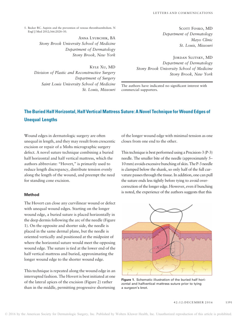 The Buried Half Horizontal, Half Vertical Mattress Suture - A Novel ...
