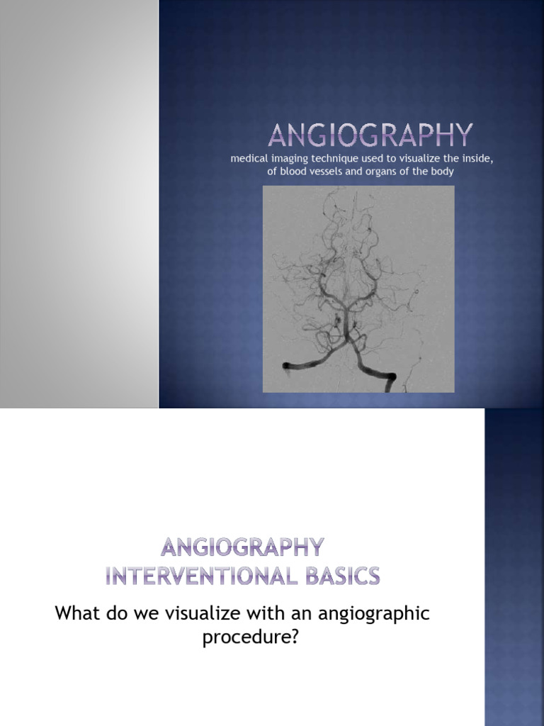 Angiography 170411210116 | PDF | Angiography | Blood Vessel