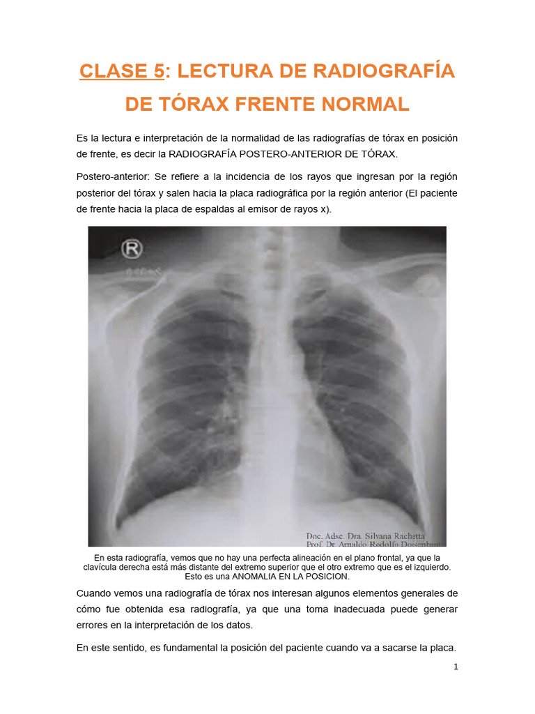 Lectura de Radiografía de Tórax Frente Normal | PDF | Aorta | Ventrículo (corazón)