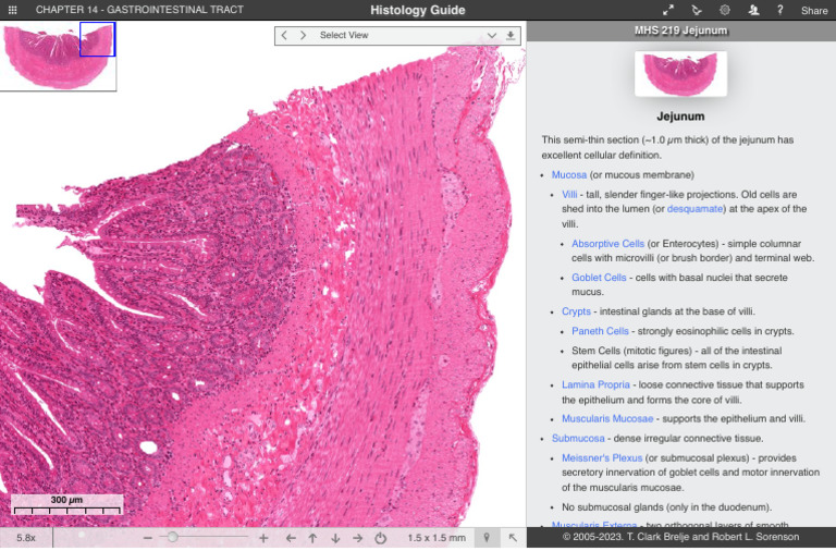 Jejunum (Small Intestine) Gastrointestinal Tract | PDF | Epithelium ...