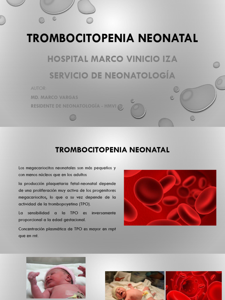 Trombocitopenia Neonatal | PDF | Especialidades Medicas | Sangre