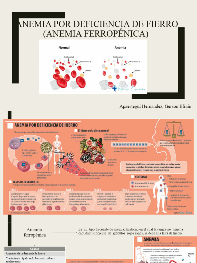 Anemia Ferropénica y Deficiencia de Hierro | PDF