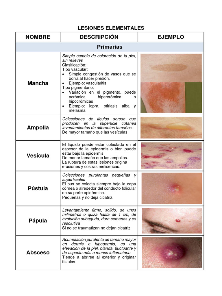 Lesiones Elementales de la Piel | PDF | Piel | Epidermis