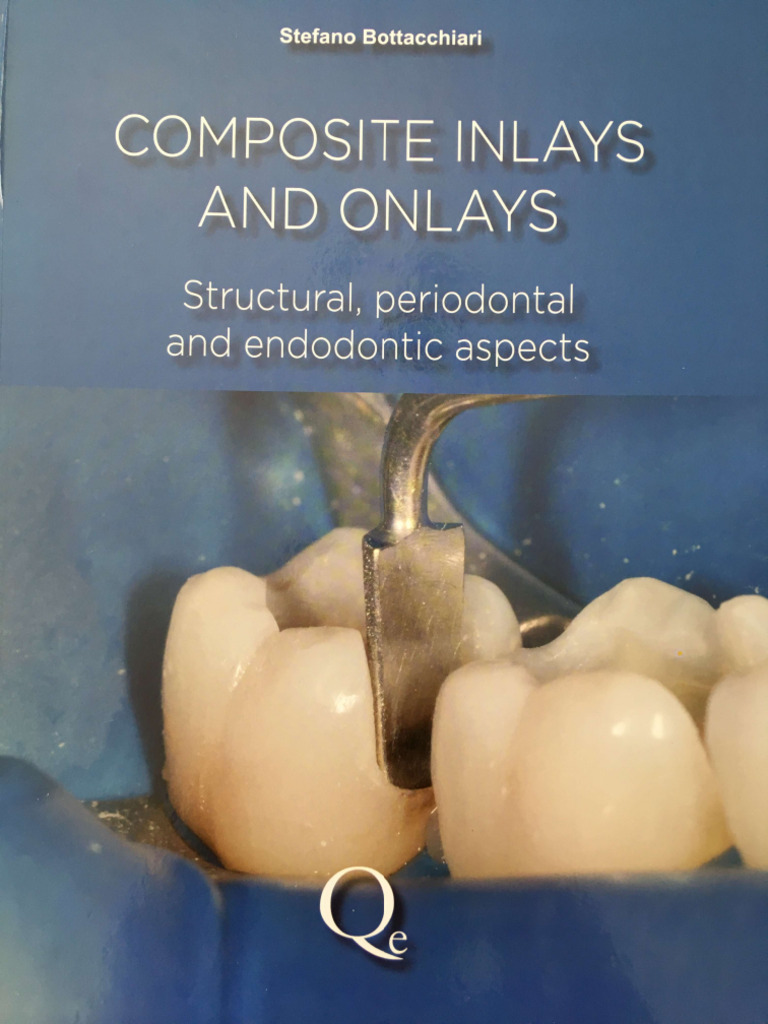 Composite Inlays and Onlays | PDF