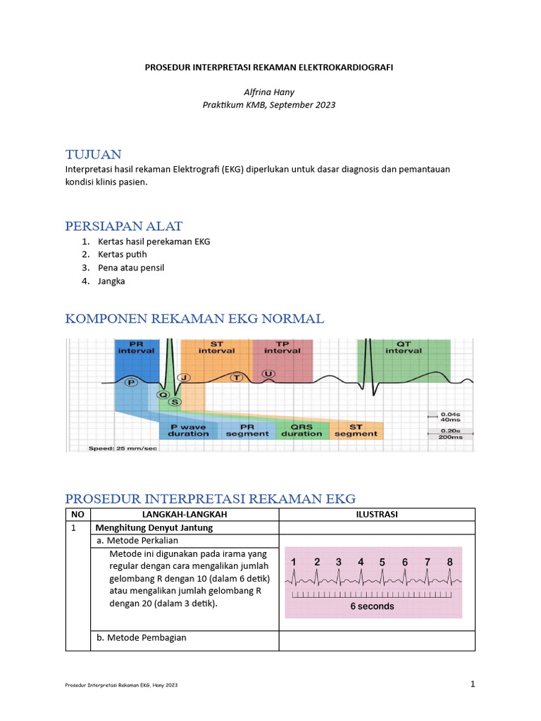 Interpretasi EKG | PDF