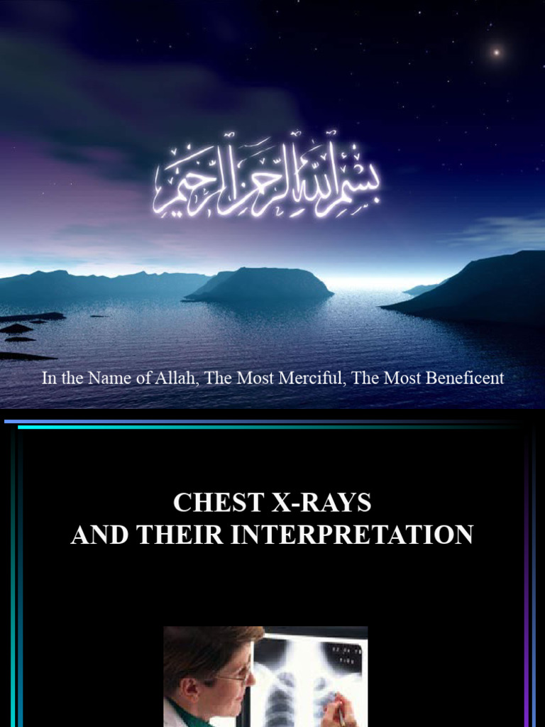 Chest X Rays | PDF