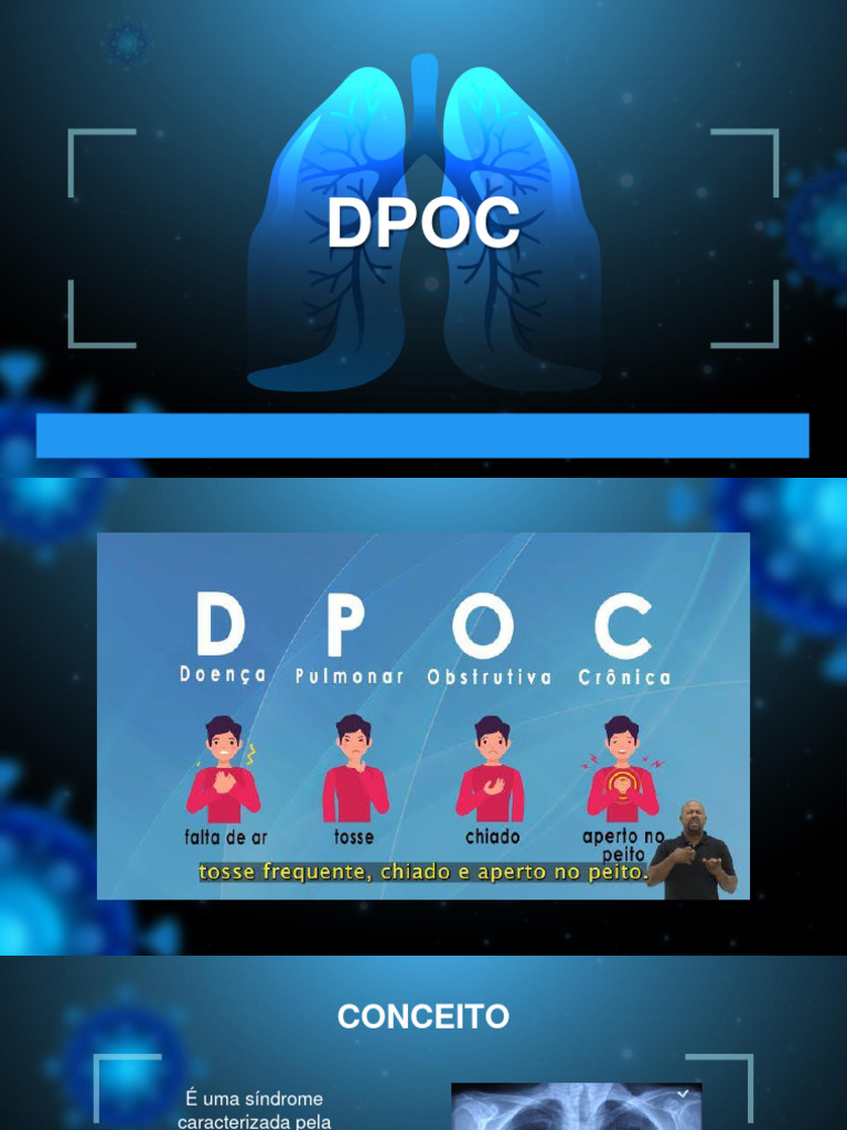 Dpoc e Asma | PDF