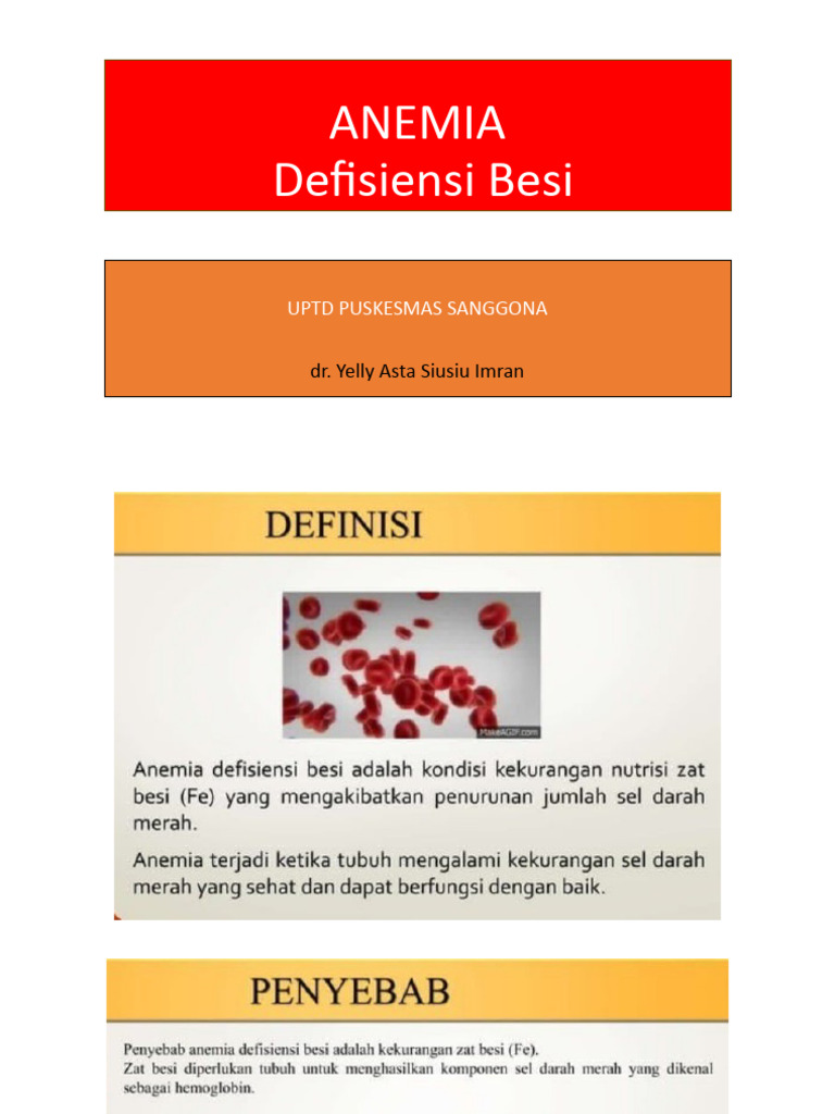 ANEMIA Defisiensi Besi | PDF