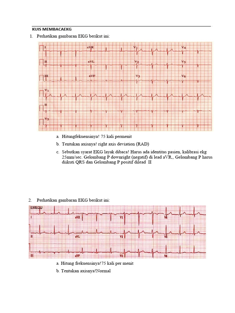 G1a119115 Dilfa Alamanda Tugas SL Ekg | PDF | Sains & Matematika