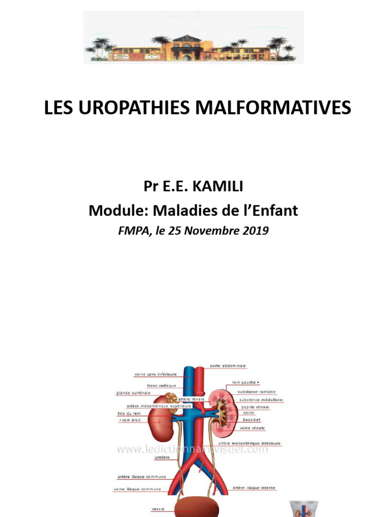 Uropathies Malformatives | PDF | Rein | Anatomie humaine