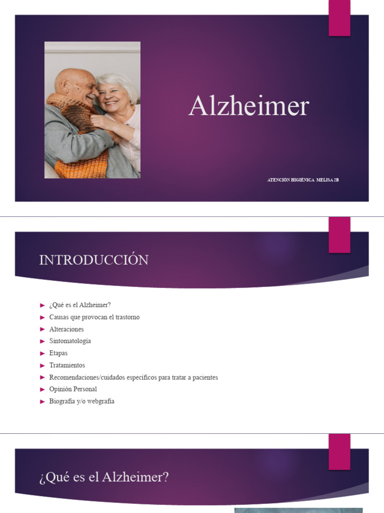 Alzheimer | PDF