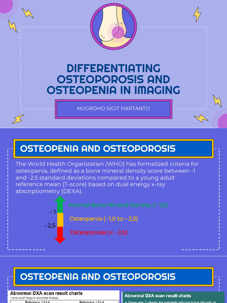 Differentiating Osteopenia and Osteoporosis in Imaging - Last Edit-1 ...