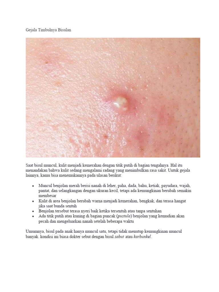 Gejala dan Penanganan Bisul pada Anak | PDF