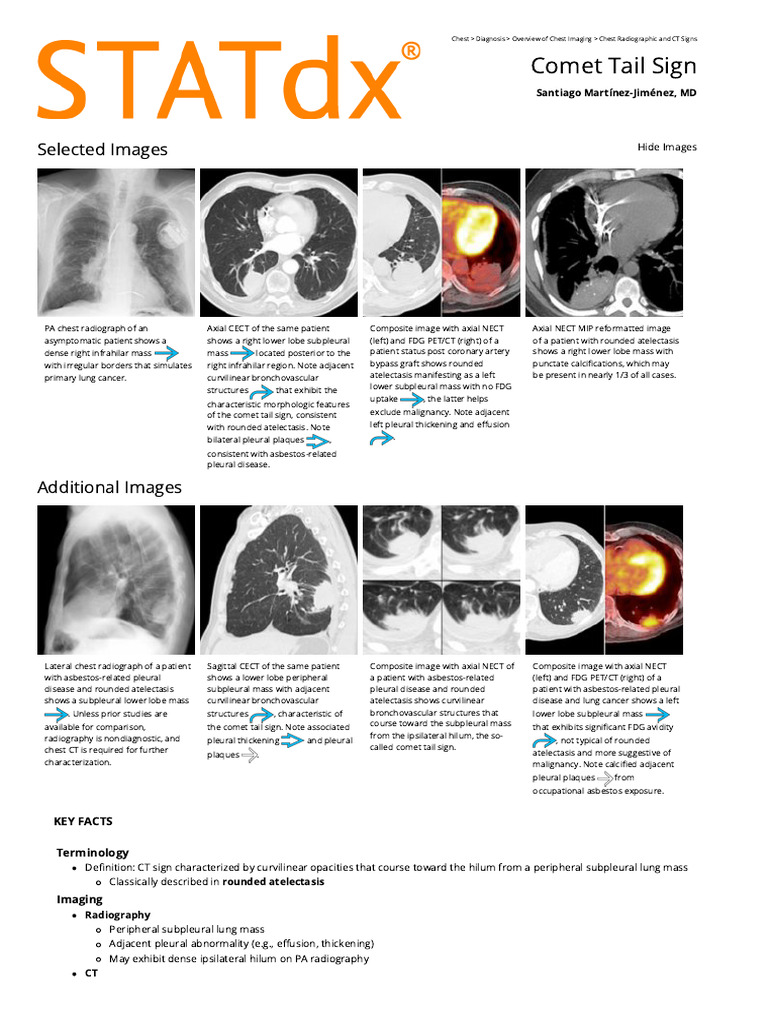 Comet Tail Sign - Print Friendly - STATdx | PDF