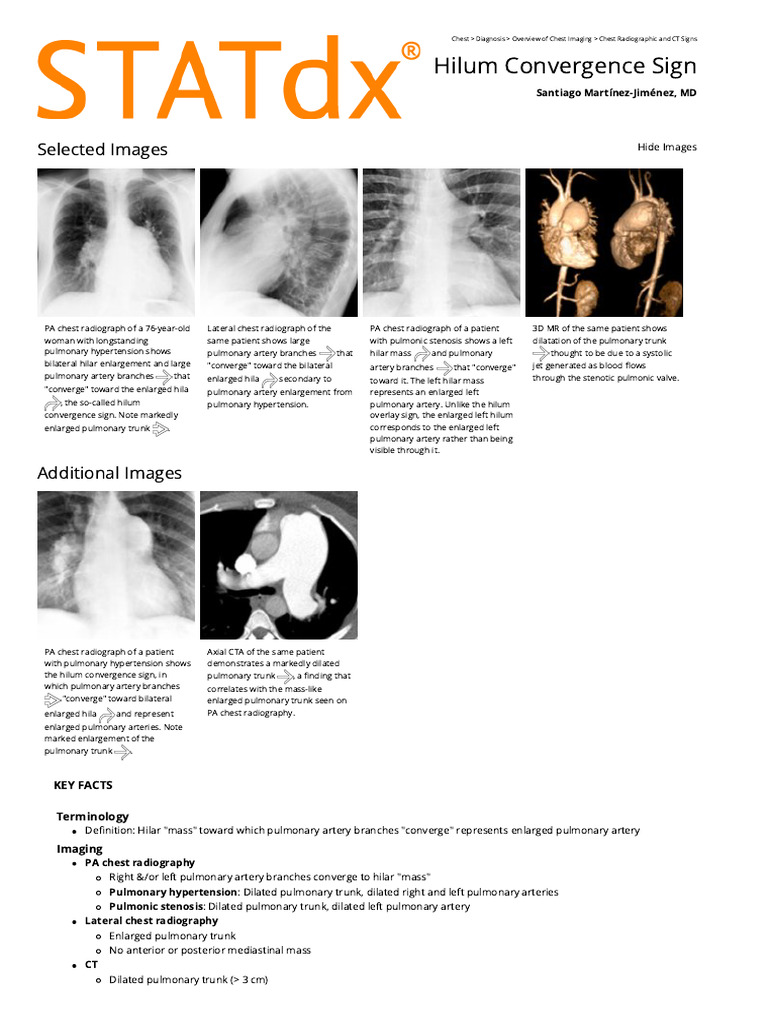 Hilum Convergence Sign - Print Friendly - STATdx | PDF | Radiography | Lung