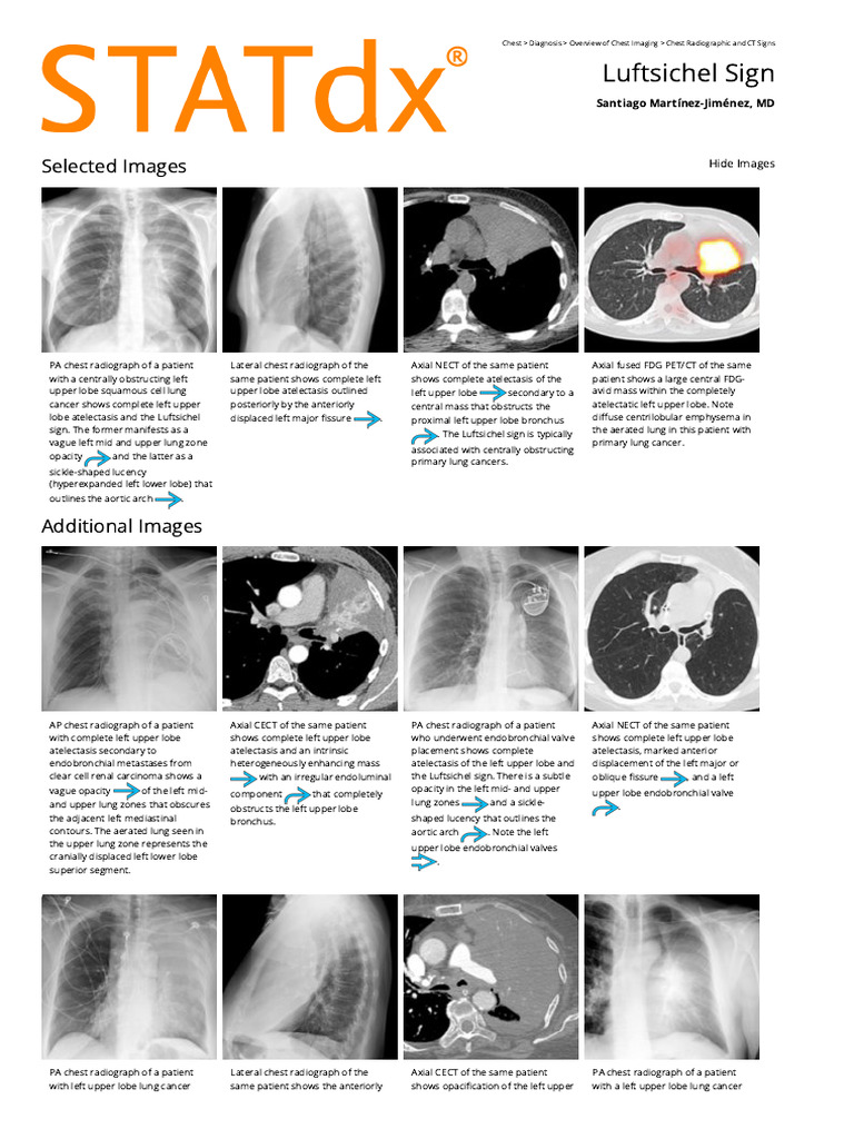 Luftsichel Sign - Print Friendly - STATdx | PDF
