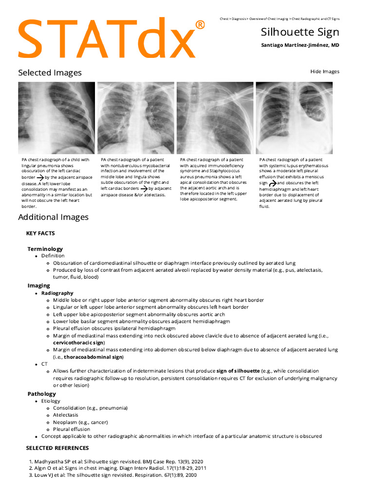 Silhouette Sign - Print Friendly - STATdx | PDF | Lung | Medical ...