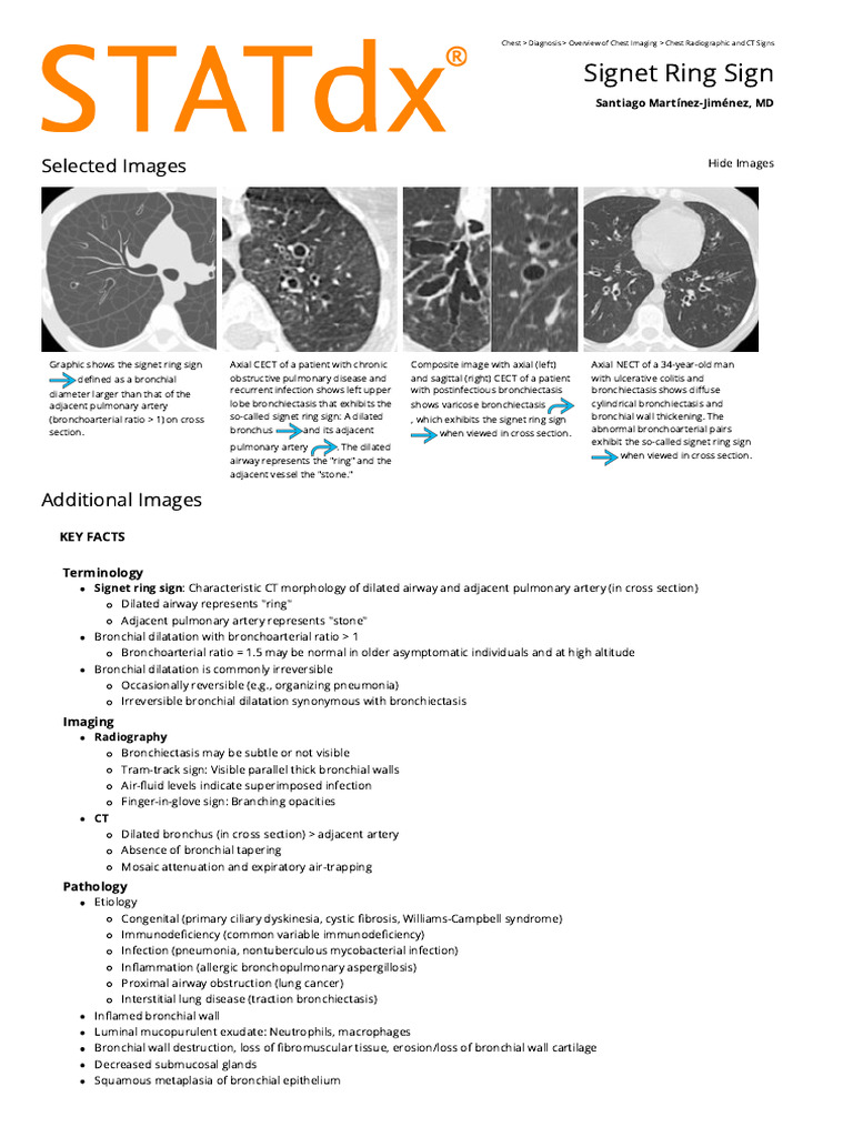 Signet Ring Sign - Print Friendly _ STATdx | PDF