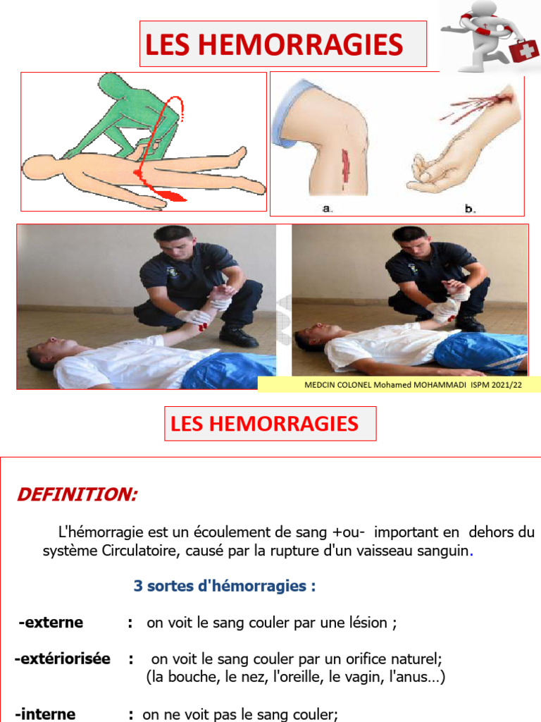 15 Hemorragies | PDF