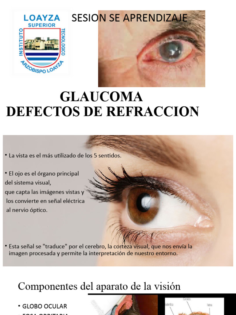 5. GLAUCOMA DEFECTOS DE REFRACCION | PDF