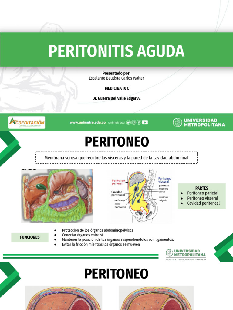 Peritonitis Aguda | PDF | Peritoneo | Abdomen