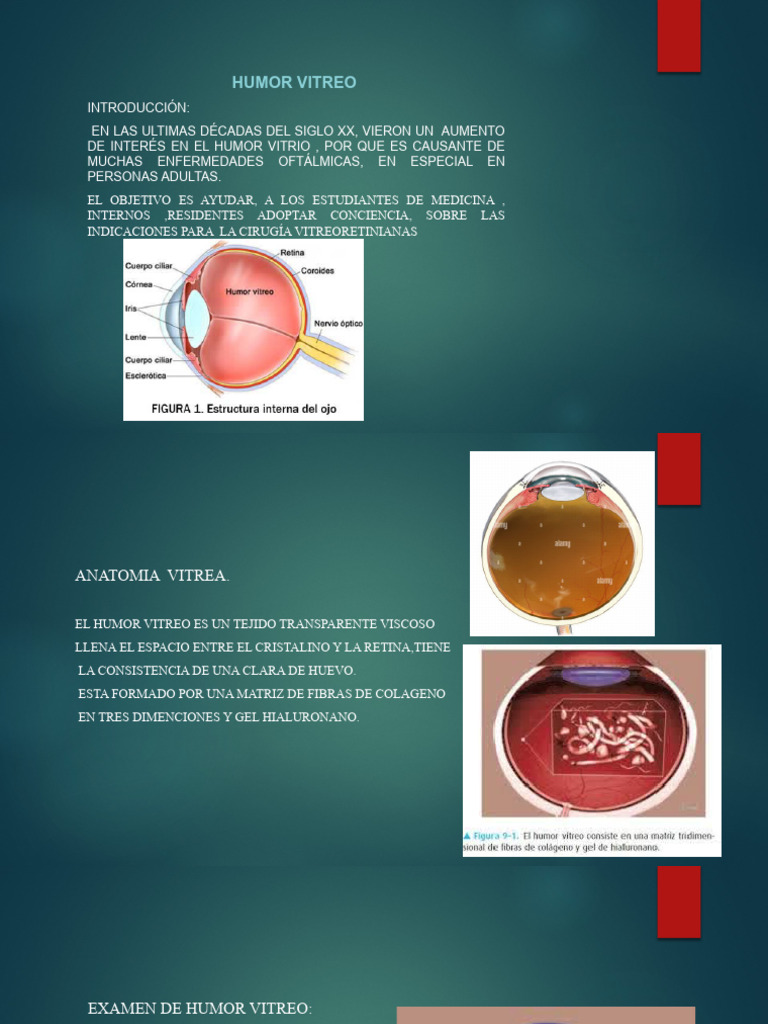 Presentación de Humor Vitreo Oftalmologia | PDF