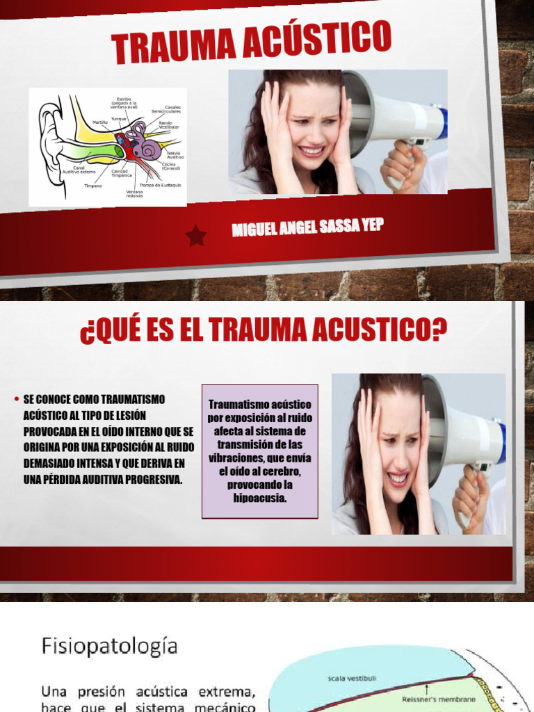 Traumatismo Acústico | PDF