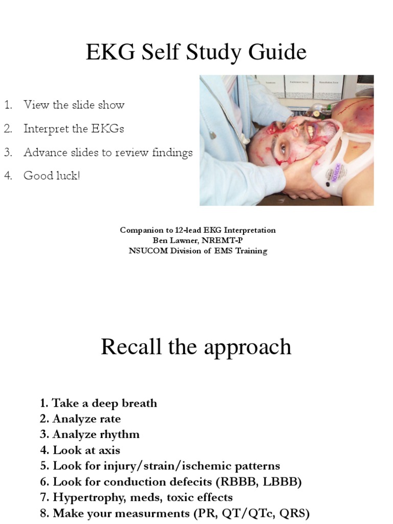 EKG Interpretation Practice Guide | PDF | Electrocardiography ...