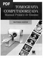 TC Dos Joelhos-Protocolo de Lyon-Tutorial | PDF