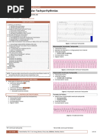 Ventricular Tachycardia - Monomorphic VT - LITFL | PDF ...