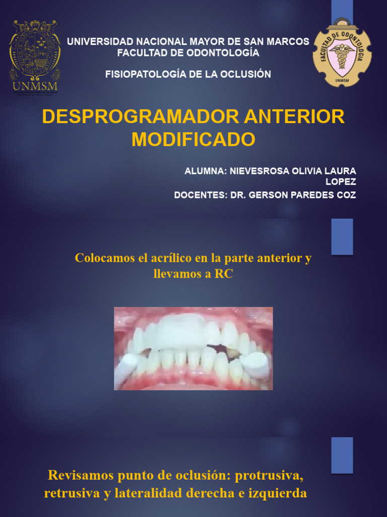 Desprogramador Anterior Modificado | PDF