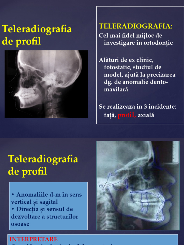 Tele RX | PDF