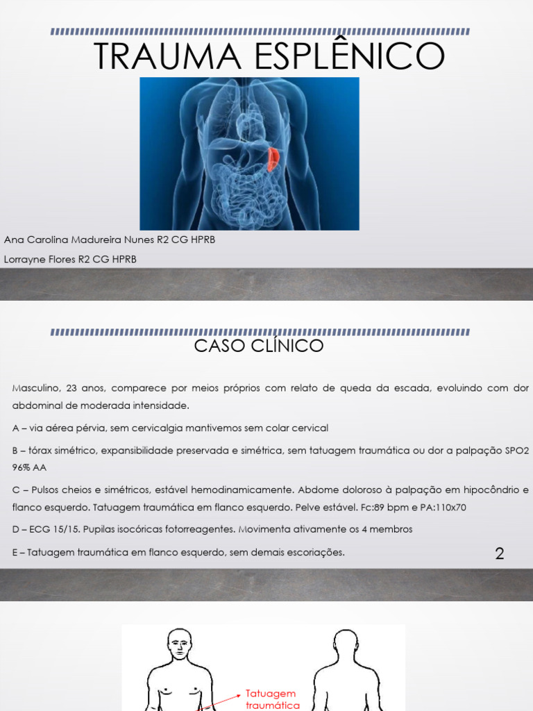 Trauma Esplênico 2 PDF | PDF