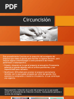 Procedimiento de Postioplastia | PDF