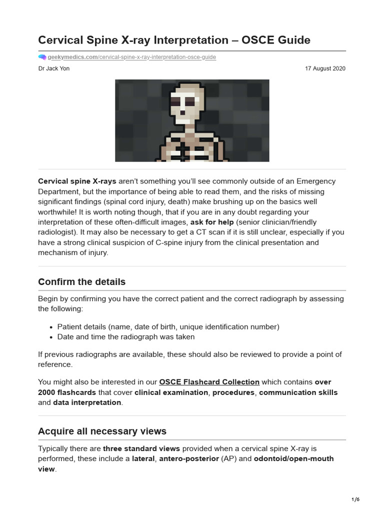 Cervical Spine X-Ray Interpretation OSCE Guide | PDF | Vertebra ...