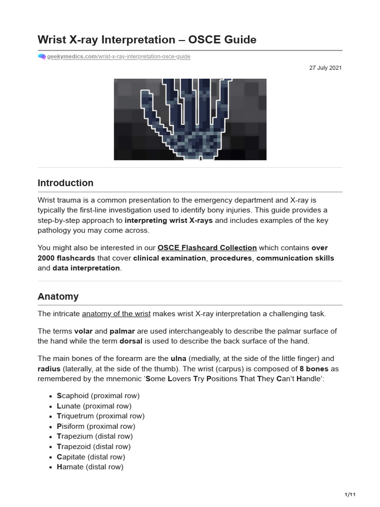geekymedics.com-Wrist X-ray Interpretation OSCE Guide | PDF