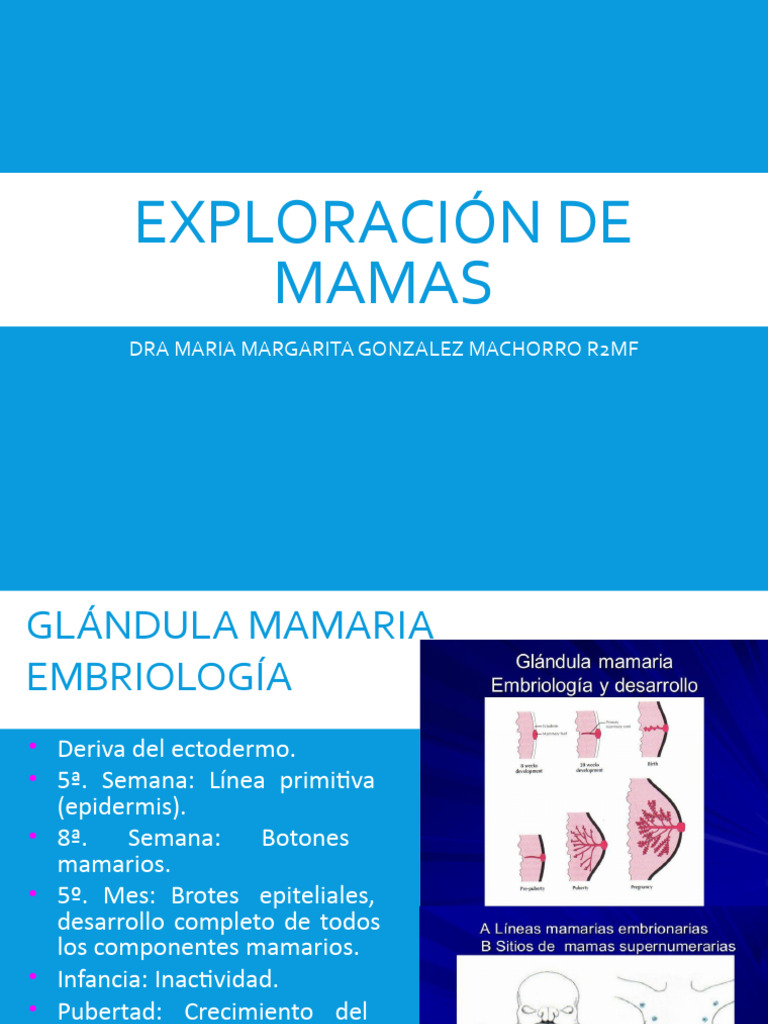 EXPLORACIÓN DE MAMAS 2 | PDF | Cáncer de mama | Pecho