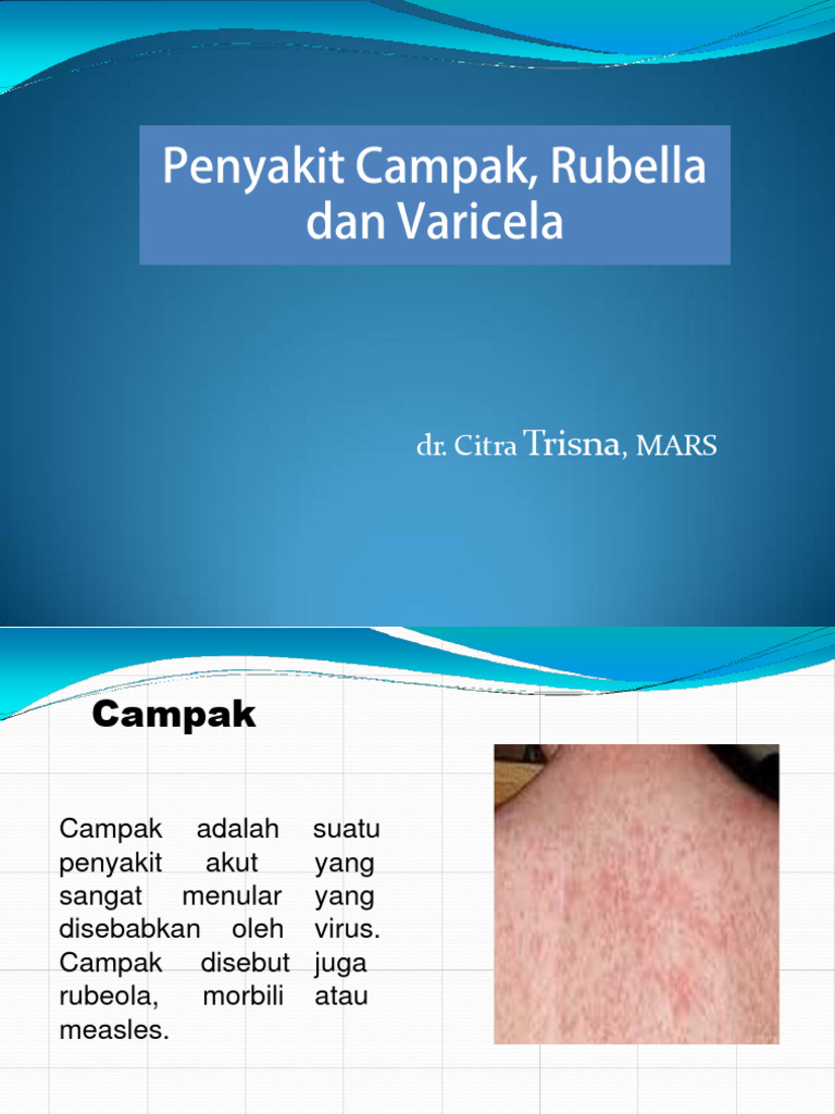 Panduan Lengkap Penyakit Campak dan Rubella | PDF