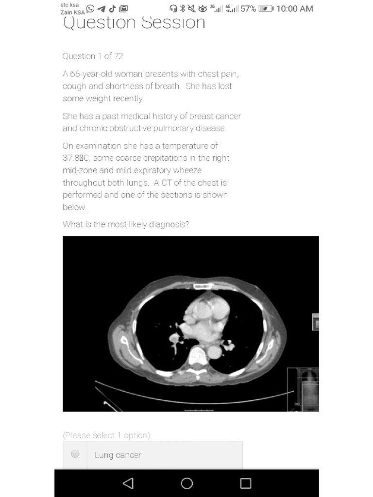 MRCP - PART ONE - ONExamination 2020 - Chest - (3) | PDF