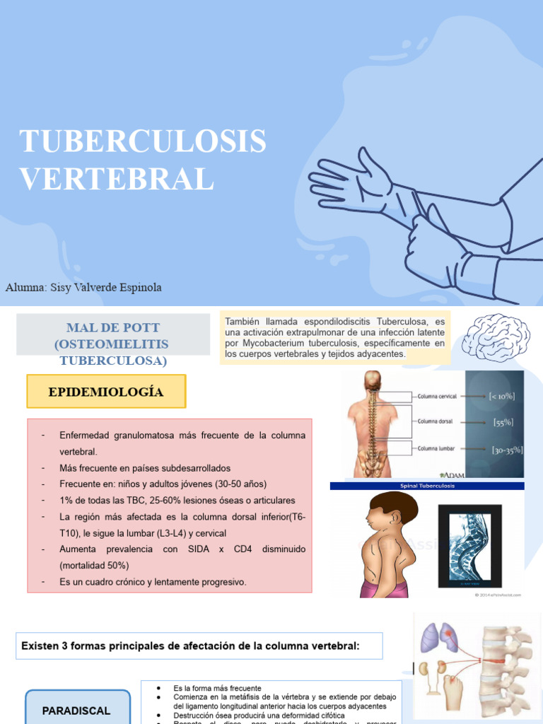 Tuberculosis Vertebral: Diagnóstico y Tratamiento | PDF | Tuberculosis ...