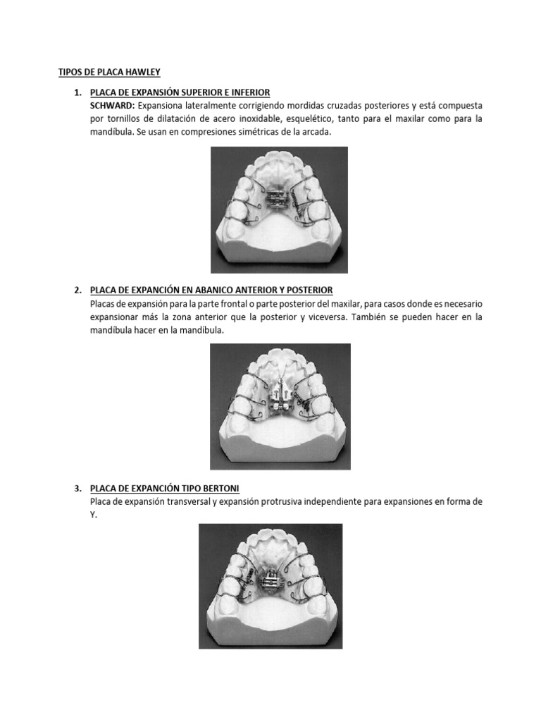Tipos de Placa Hawley | PDF
